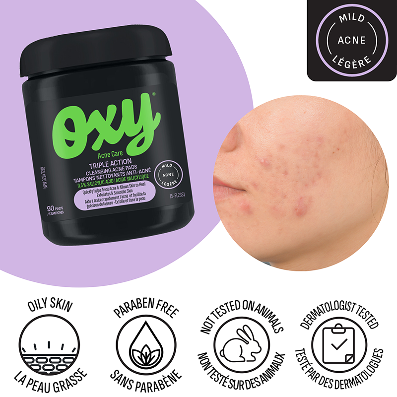 Clear Skin Made Easy, Thanks To Oxy® Triple Action Cleansing Acne Pads – OXY® Acne Care
